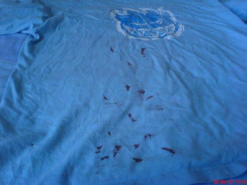 Blood Stain On Clothes