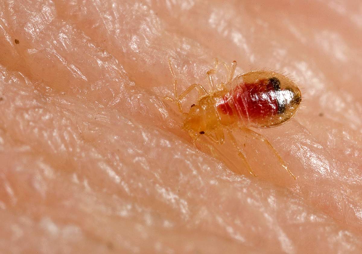 12 Easy DIY Ways to Get Rid of Bed Bugs Quickly: A Killer Guide - Dengarden