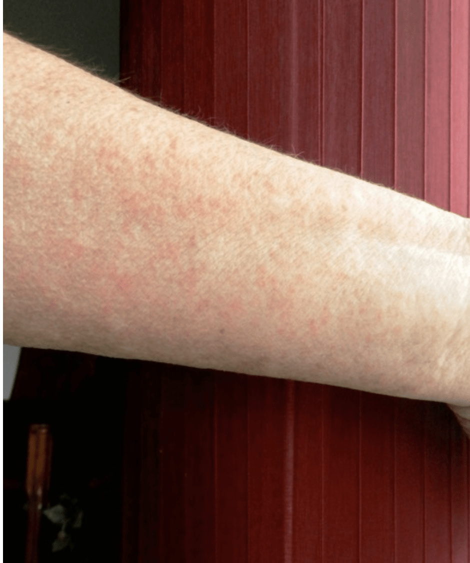 How to Care for Firestick Succulents - Dengarden