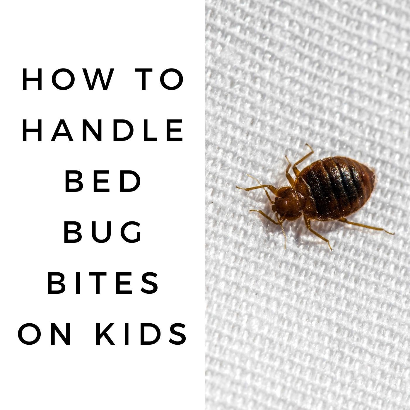 How to Handle Bed Bug Bites on Kids - Dengarden